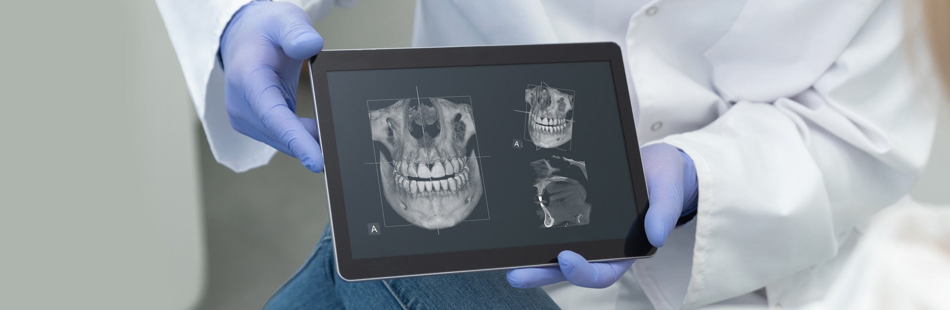 In-House 3D CT-Scan Weston, FL | In-House 3D CT-Scan near you